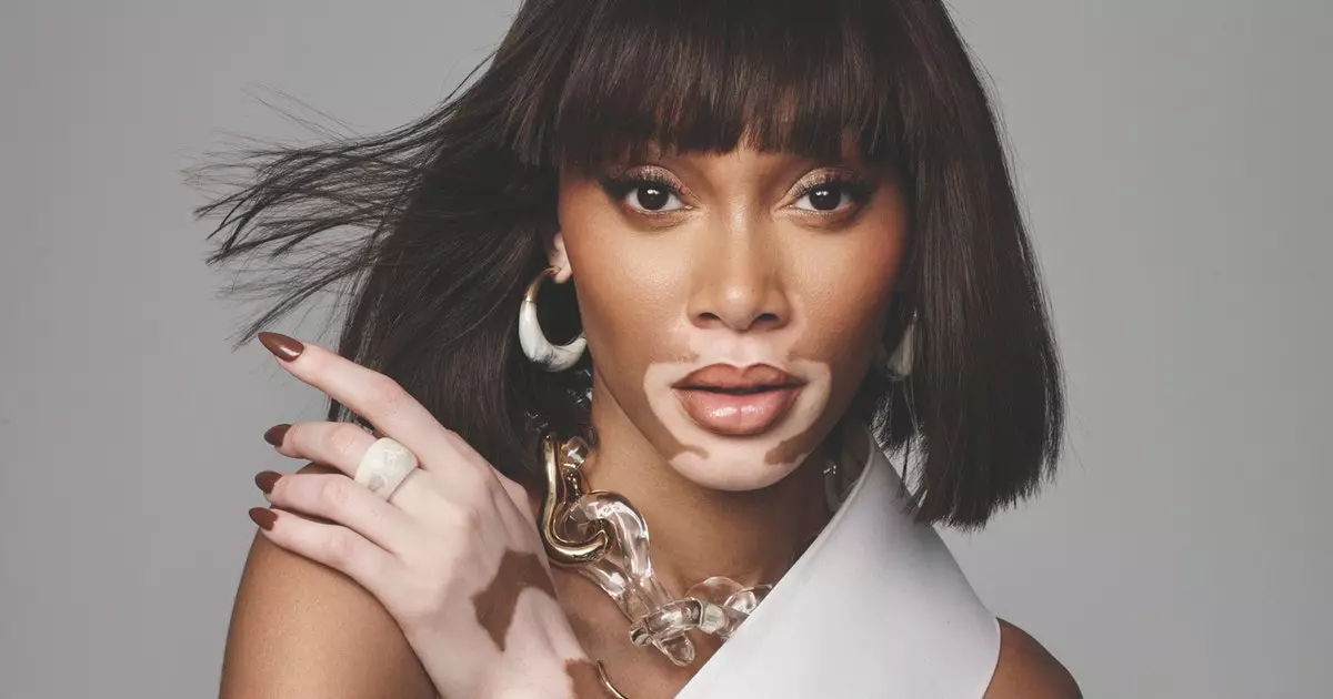 Lihora tse 17 le Supermodel & Beauty Entrepreneur Winnie Harlow